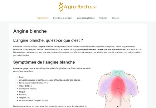 Angine Blanche | Avis Site
